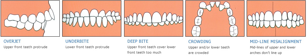 Orthodontics – Pennyhill Dental Care